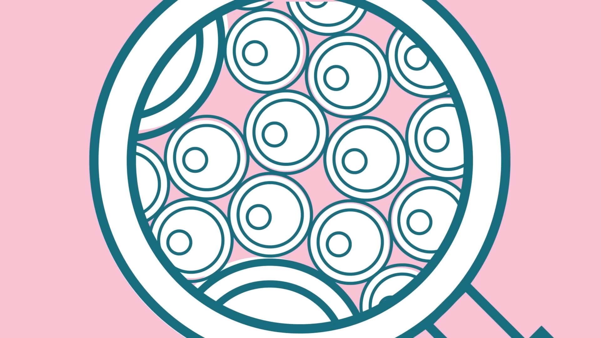 ...In Vitro Fertilization (IVF) Work?什么是试管婴儿?试管婴儿流程讲解