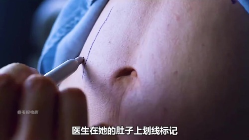 女孩想除掉雀斑变美,可医生却让她拿肚子里的零件交换