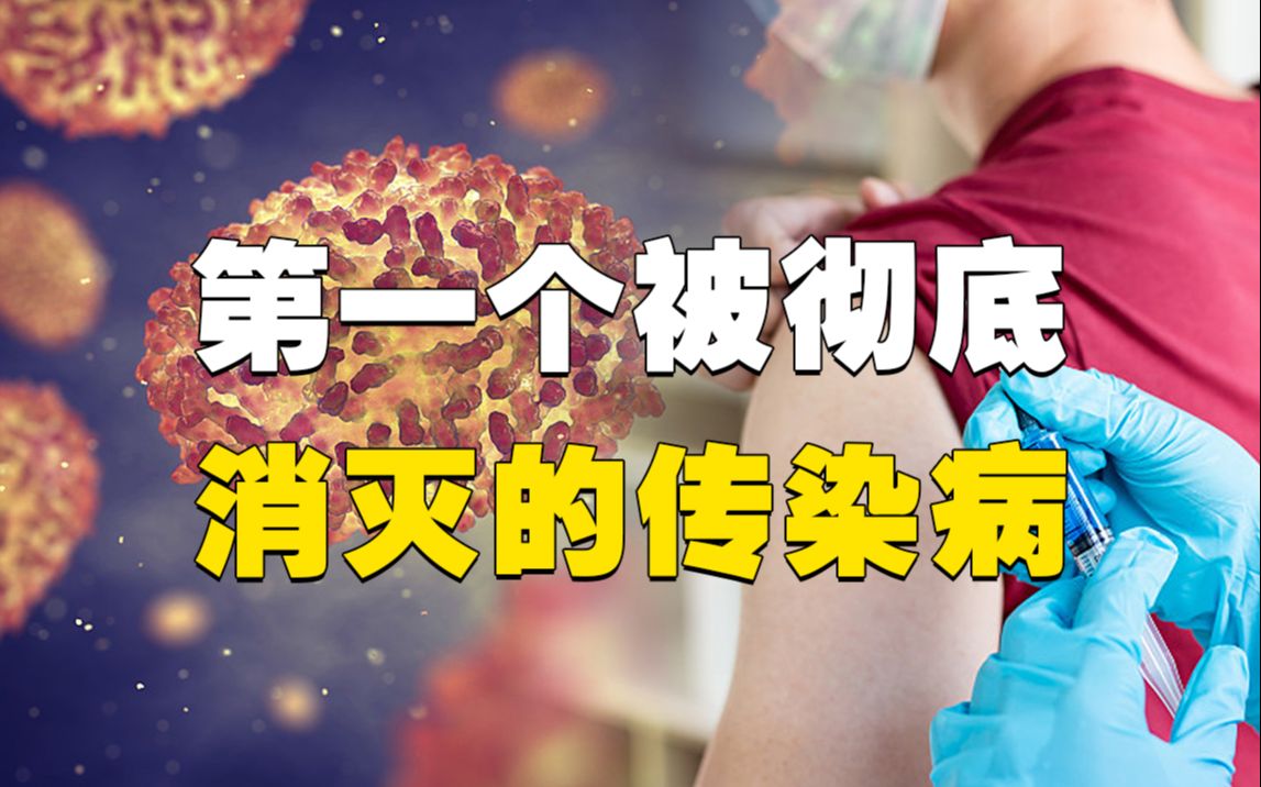 传染率远超新冠,累计病逝数亿人,第一个被人类消灭的传染病天花