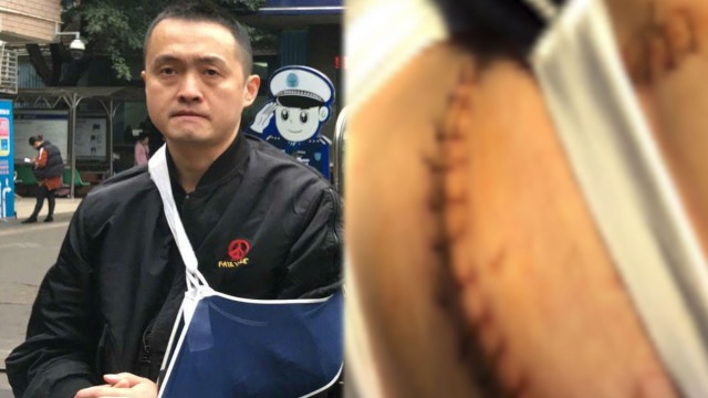 成都一男子下班骑车途中与狗相撞导致九级伤残 工伤认定受阻