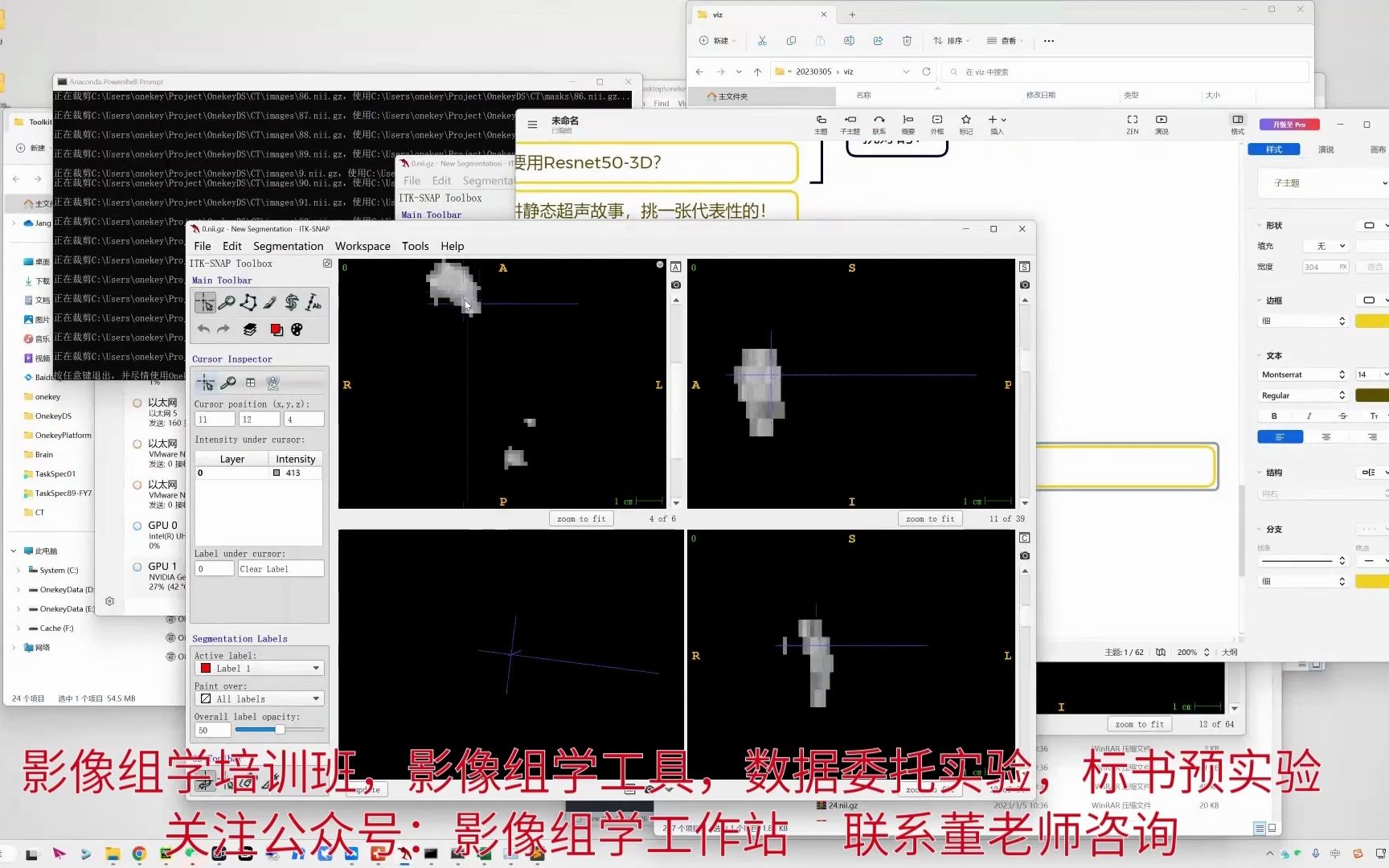 影像组学中如何判断那个模型好坏