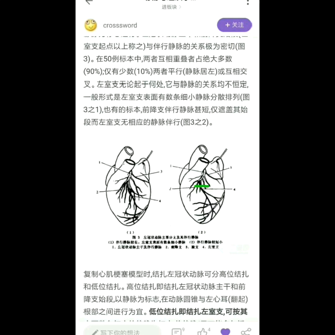 大鼠缺血再灌注/心肌梗死-结扎位点定位