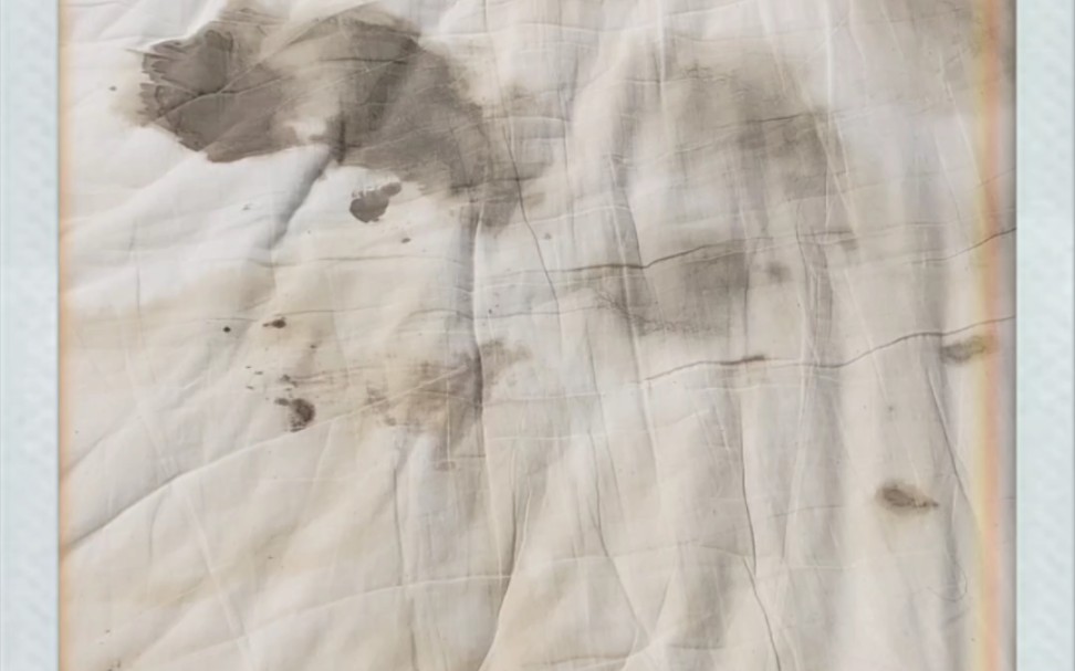 东川人民医院的住院部现状,不堪入目。