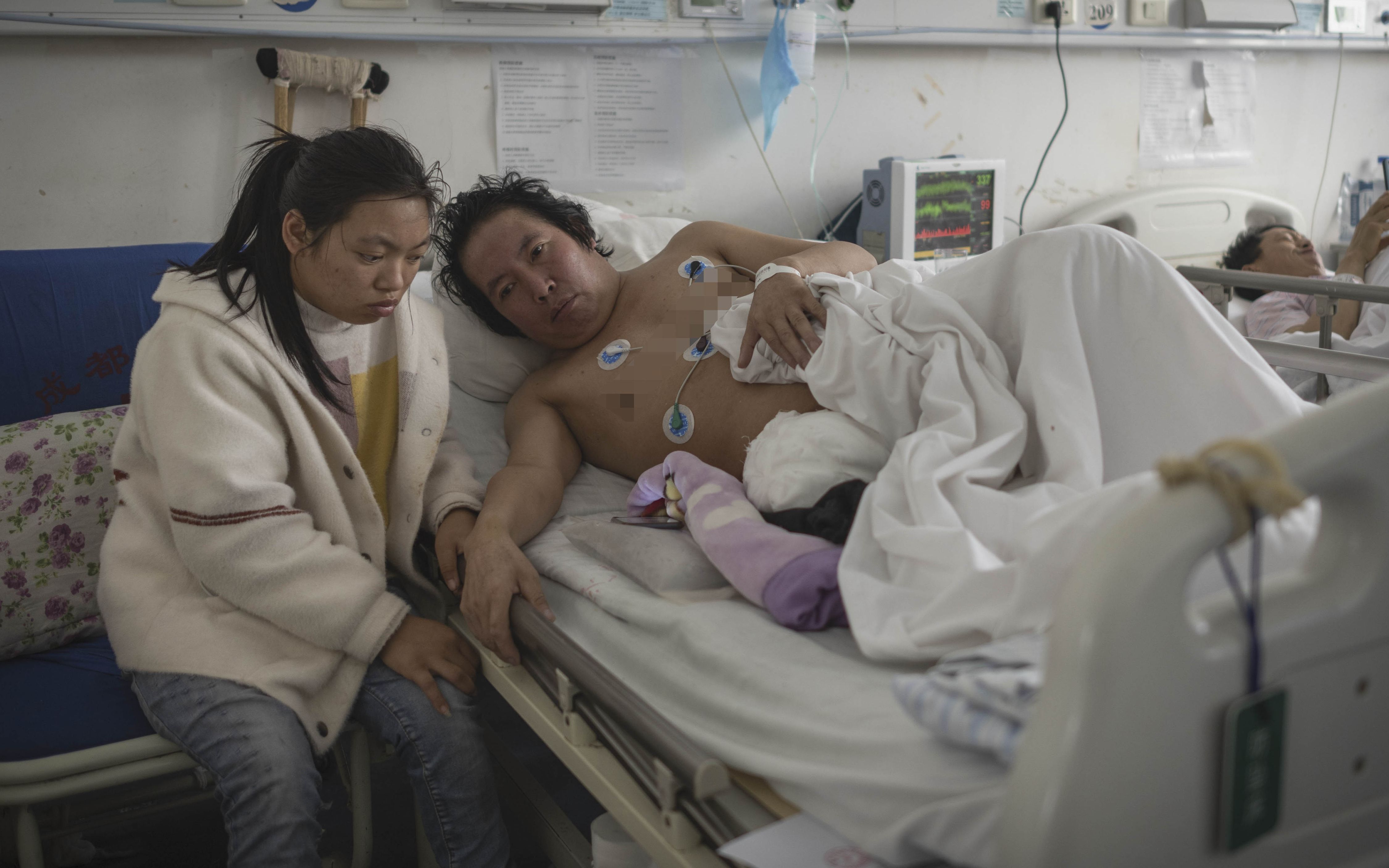 泪目!残疾女儿守护截肢爸爸,父女加一起凑不够一双完整的腿