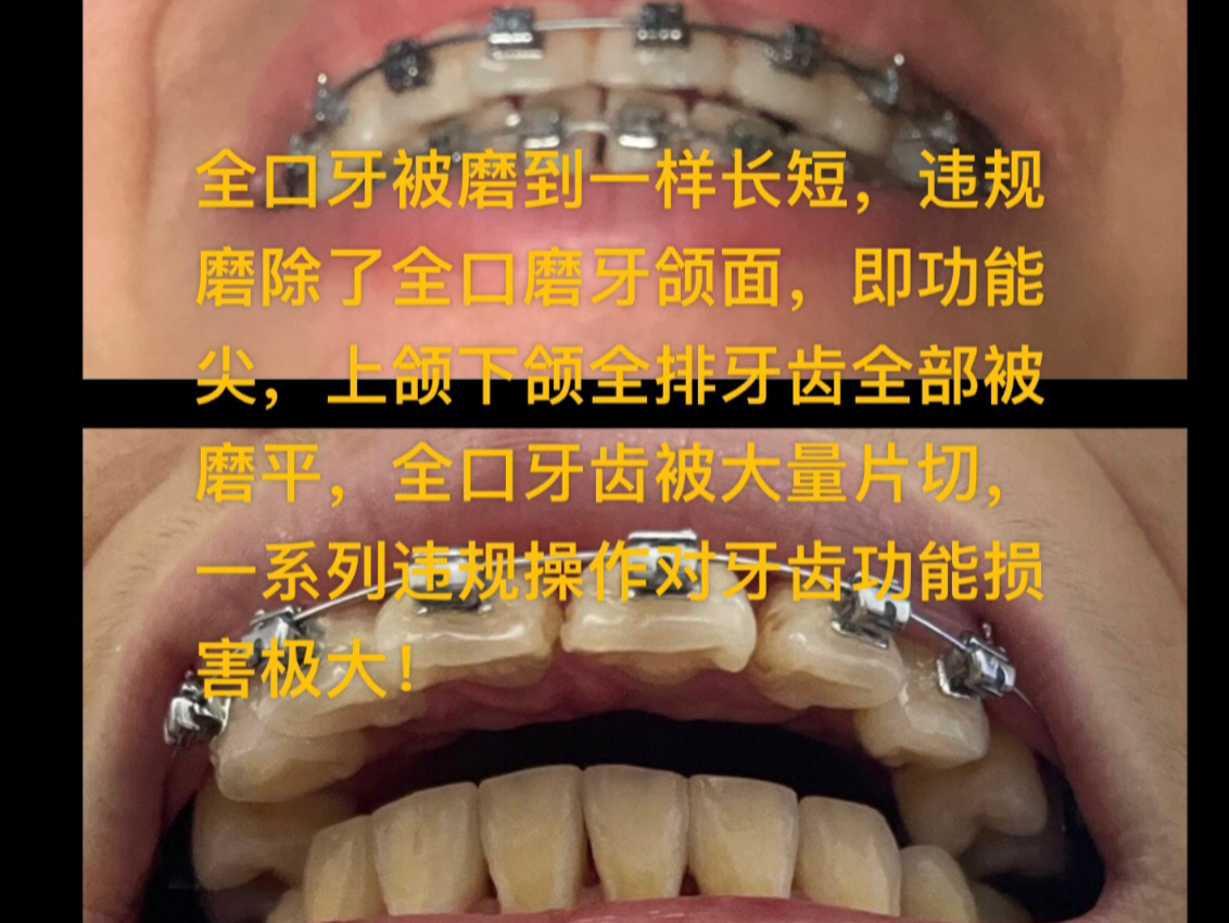 ...多名“白衣天使”非法行医把患者当实验品,矫正六年失败的惊悚案例!