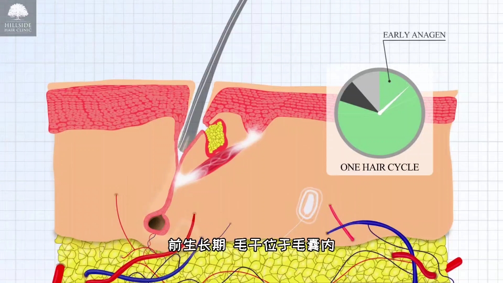 原来头发不是一起长,头发的生长过程,3D演示。