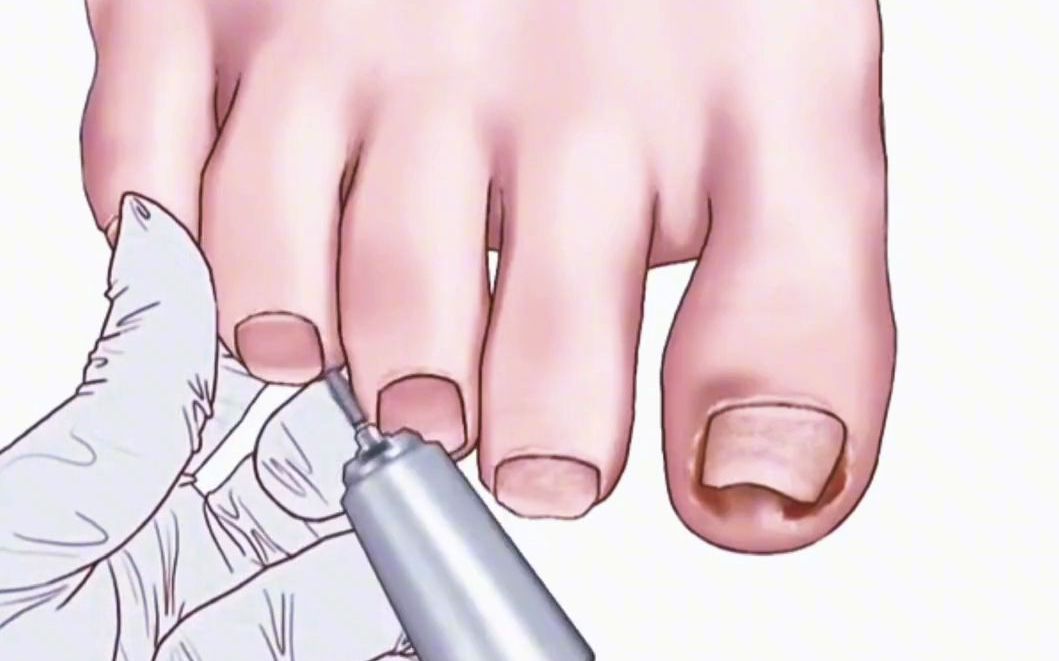【声控解压】解压小游戏～脚趾甲啦