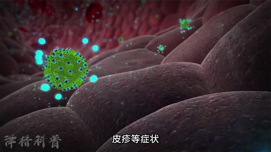 艾滋病入侵揭秘:HIV是如何攻击人体?