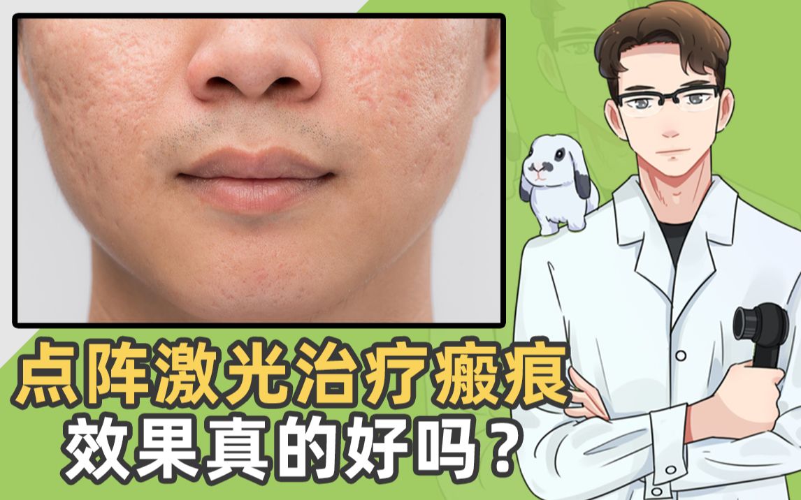 【皮肤科刘依森】用点阵激光治疗瘢痕,效果真的好吗?
