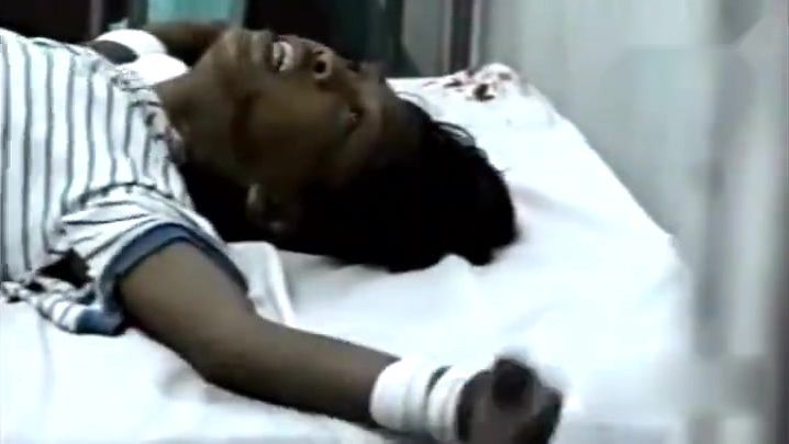 实拍狂犬病患者从发作到死亡的瞬间,真是太可怜了!