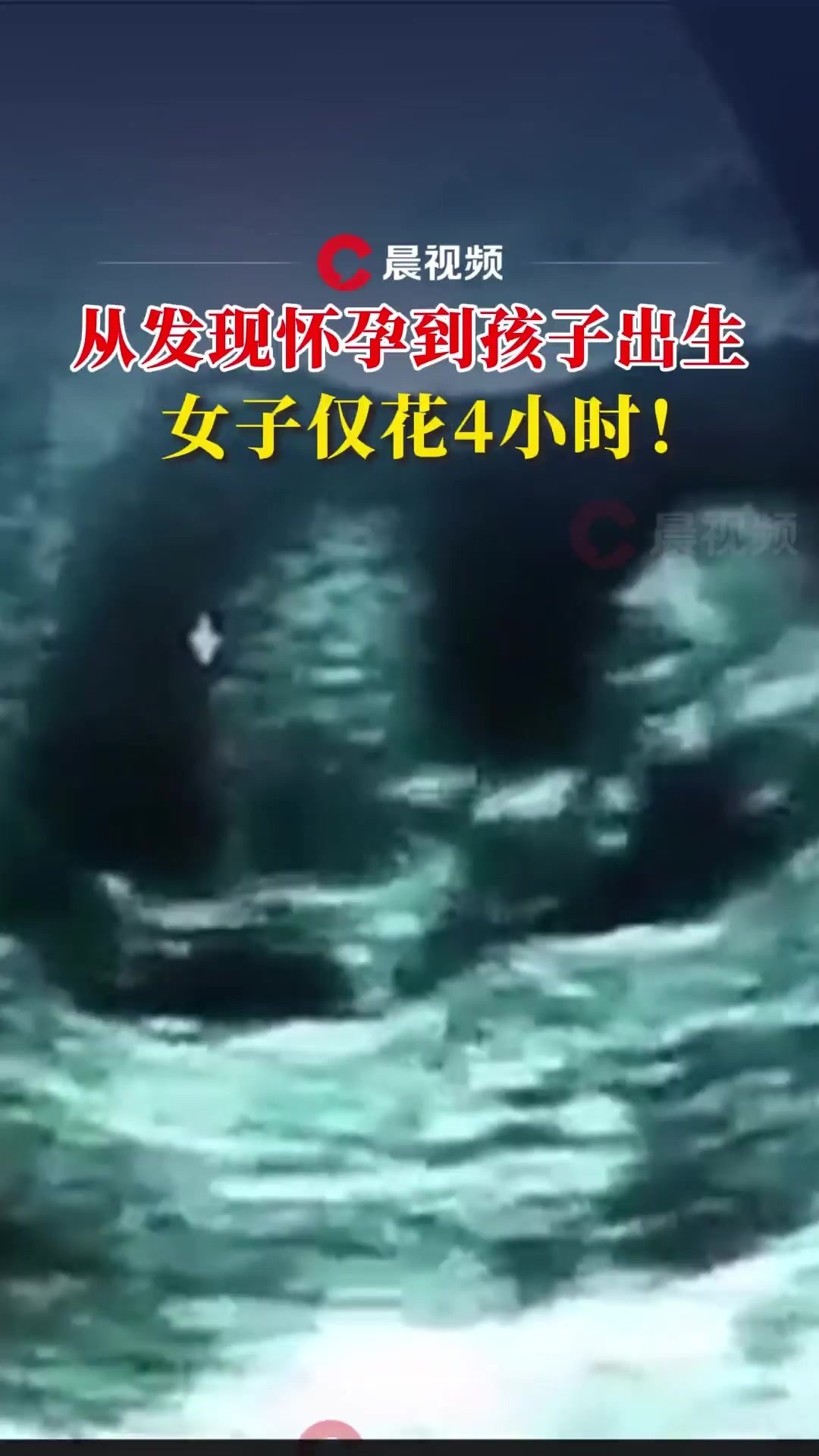 从发现怀孕到孩子出生,女子仅花4小时!