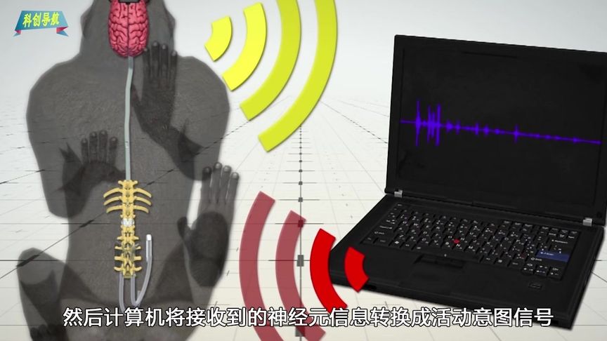 无线wifi大脑来袭,隔空传递神经信号,有望让瘫痪患者健步如飞