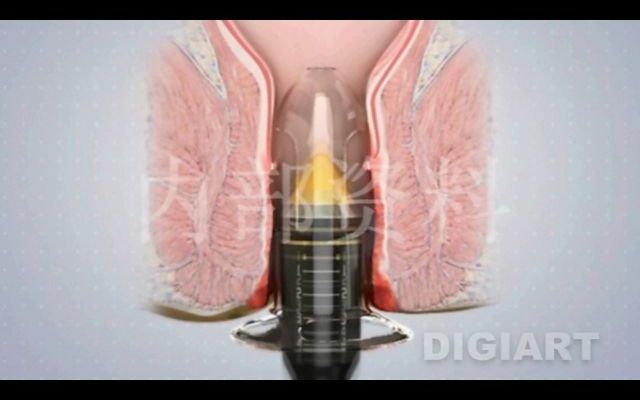 医疗动画专业演示公司,医学三维制作哪里有