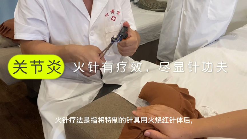 减少关节炎痛苦,火针疗法有疗效!尽显“针”功夫 #中医 #火针