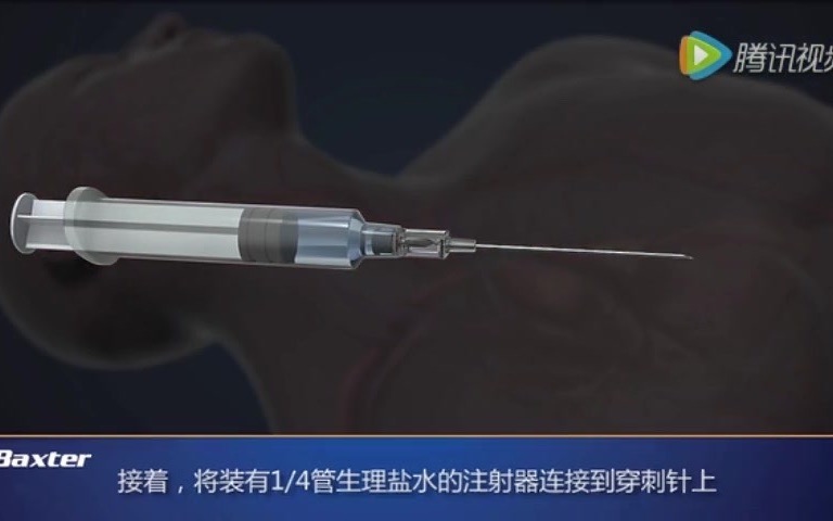 《深静脉穿刺-百特》动画视频