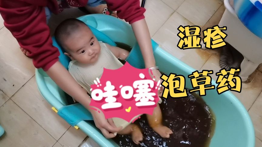 六个月宝宝湿疹老是不见好,医生开了中药泡澡,希望快些好