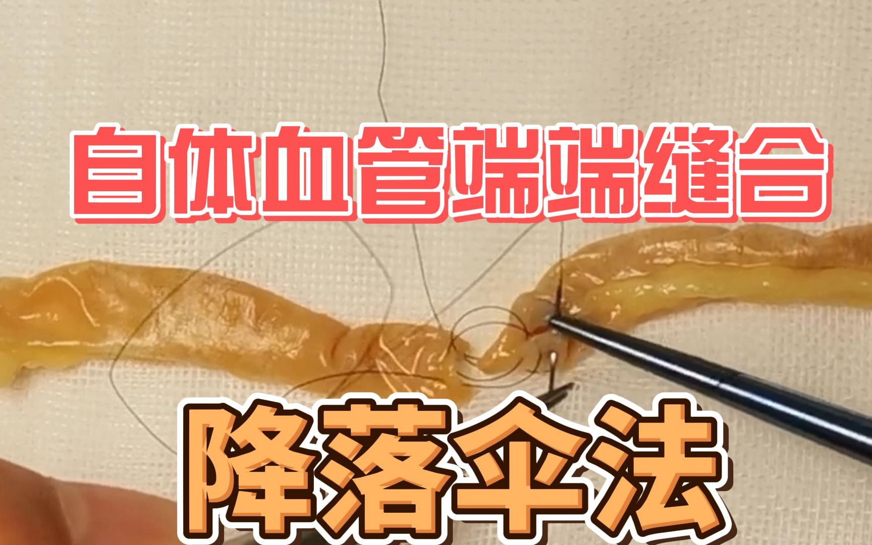 血管缝合训练8:模拟自体血管的端端缝合(降落伞法)