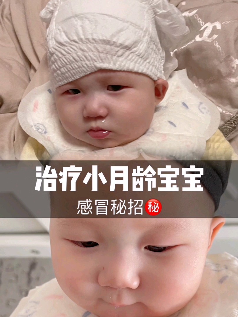 小月龄宝宝感冒生病指南|不吃药|三天痊愈育儿百科全书