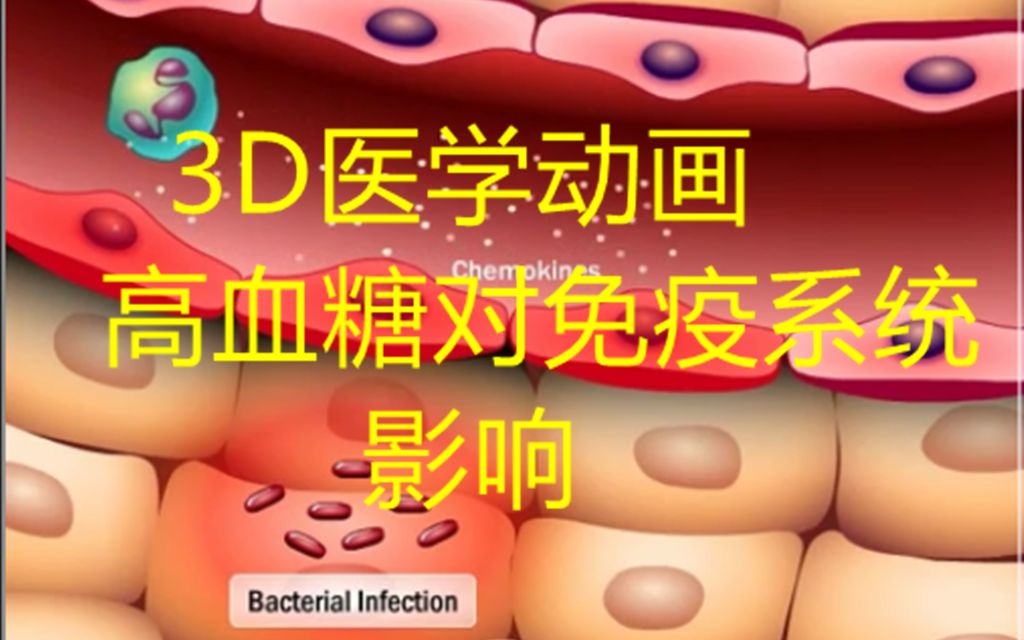 高血糖对免疫系统的影响-3D医学动画