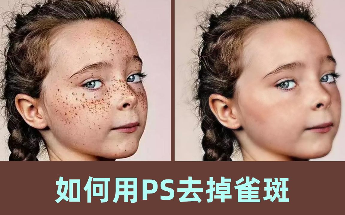 如何用ps消除雀斑,高低磨皮去掉斑点