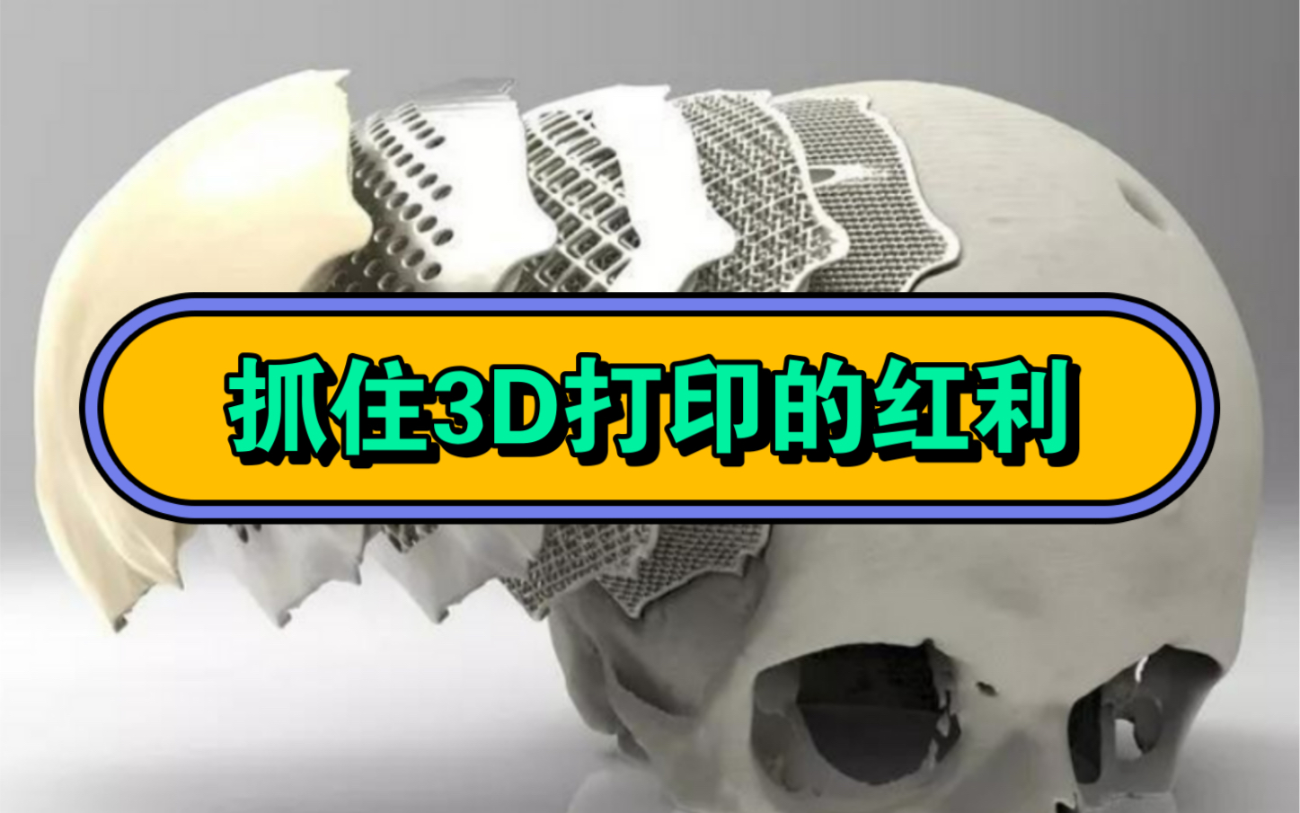 怎样抓住3D 打印医疗器械的红利?一篇全感搞懂