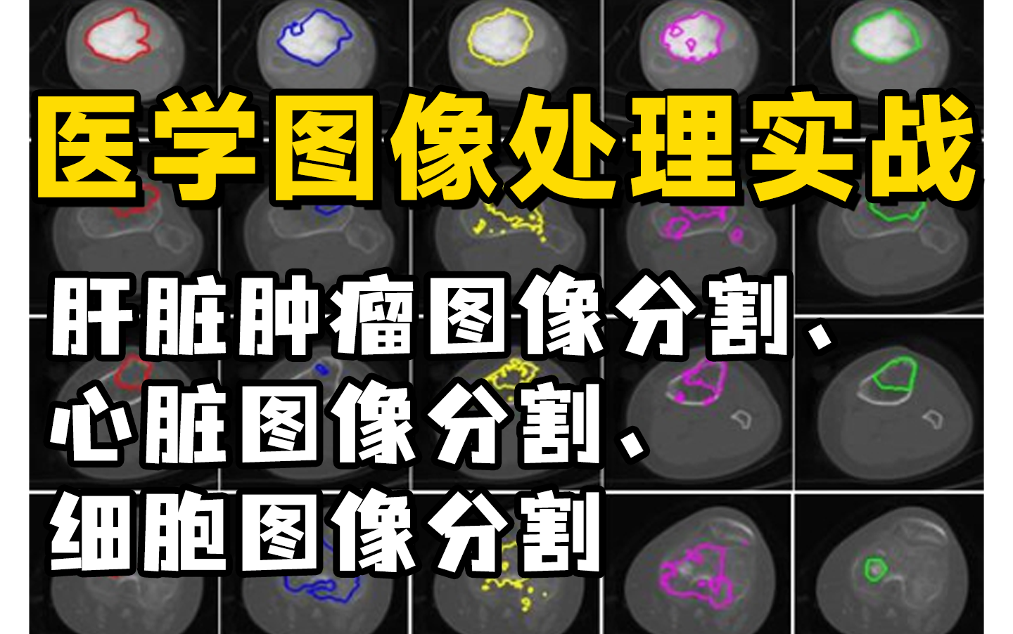 基于深度学习的【医学图像处理实战】肝脏肿瘤图像分割、心脏图像...