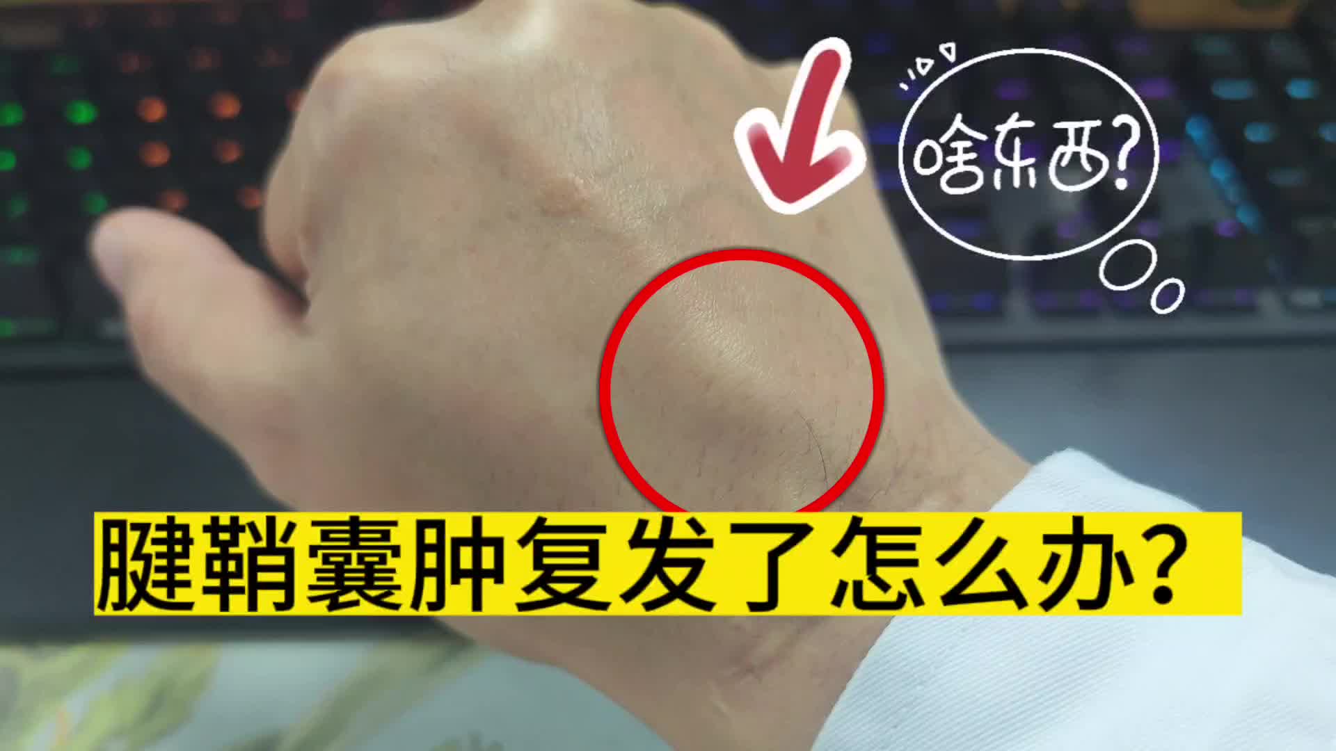 腱鞘囊肿复发了怎么办?#腱鞘囊肿 #小妙招 #教你一招 #骨科医生 #...