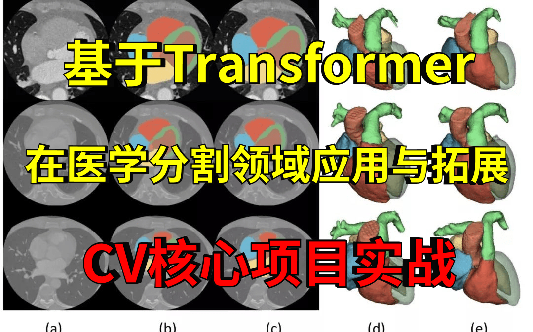 【CV核心项目实战】基于Transformer在医学分割领域应用与拓展,太强...