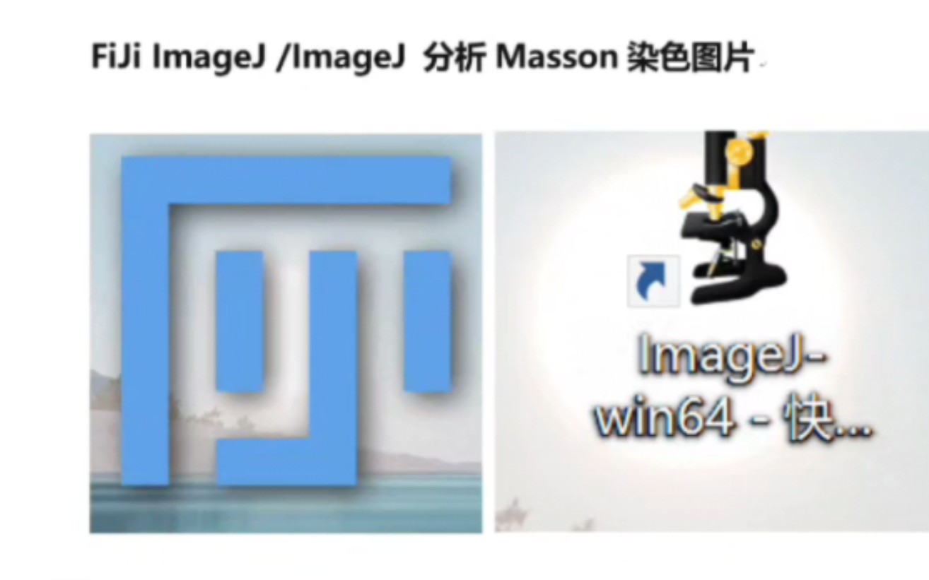 利用Fiji Image J计算组织Masson染色胶原容积分数的方式。