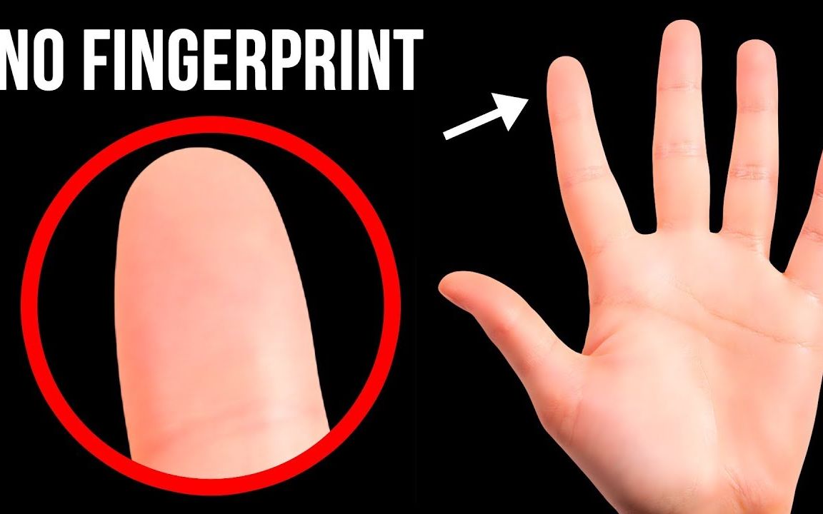 如果人类手上没有了指纹,会出现什么后果?有点可怕啊…@油兔不二...