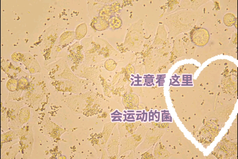 【染菌的细胞】体外培养细胞的染菌镜下观察,生物生命科学类实验...