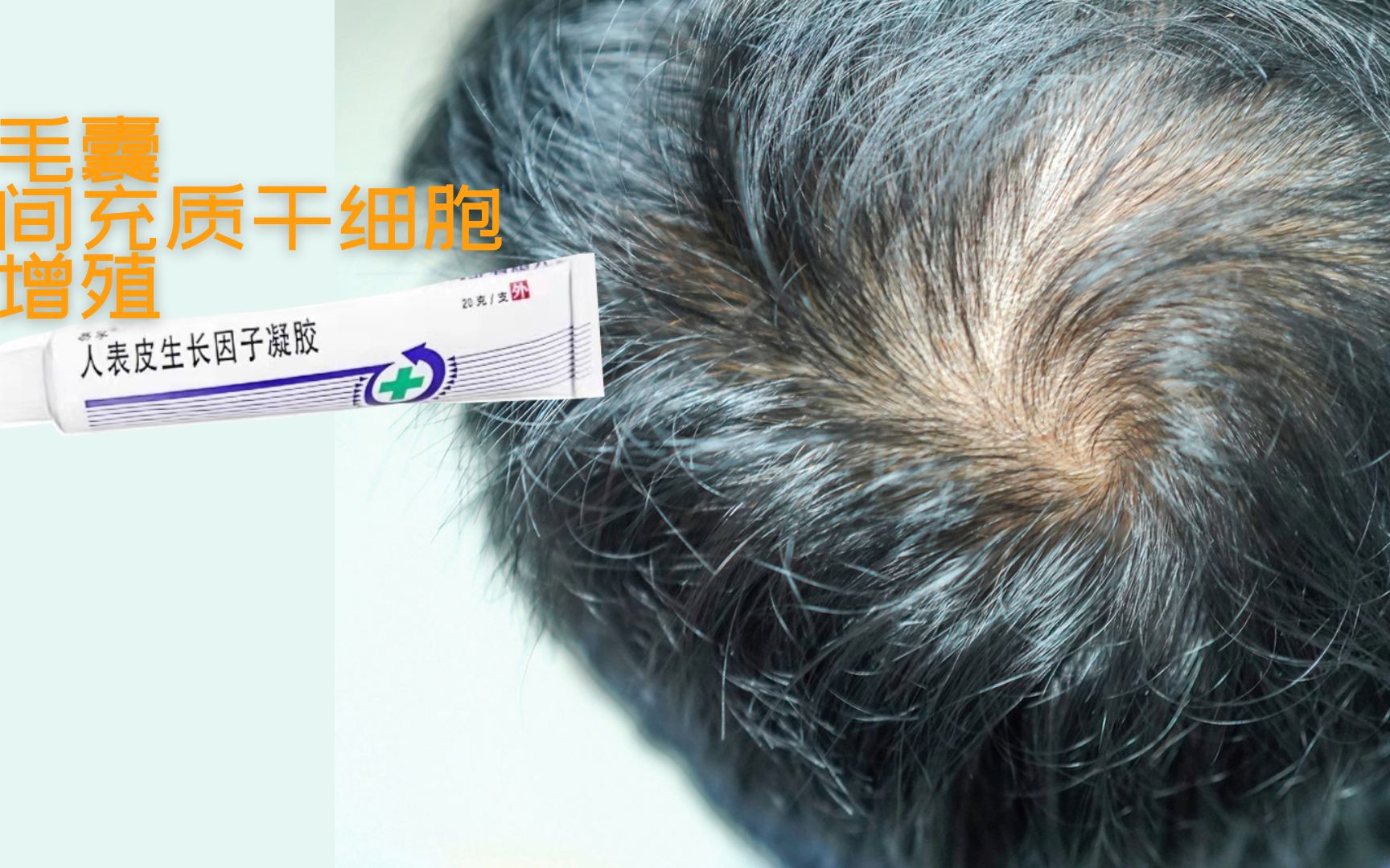 易孚表皮生长因子(EGF)生发的利弊
