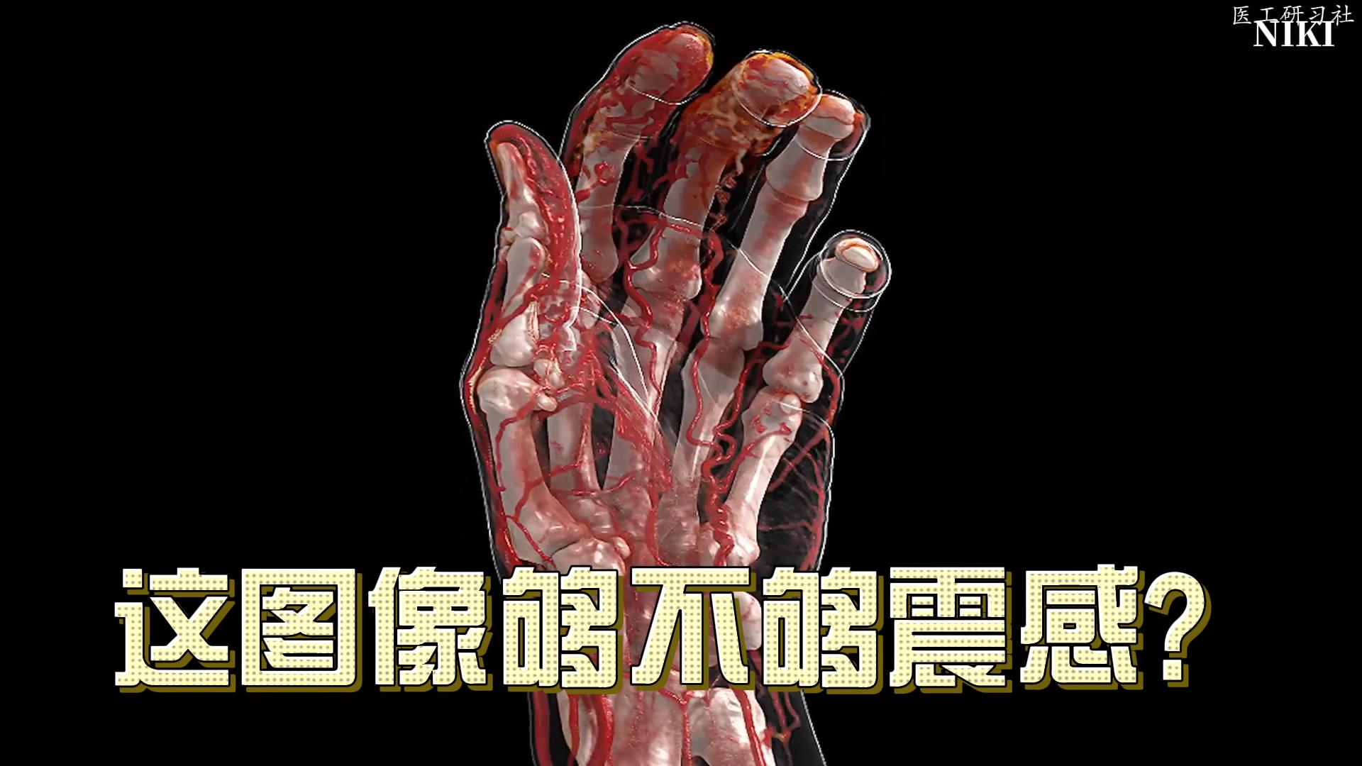 超逼真图像,这就是为什么医生越来越青睐于CT三维重建!