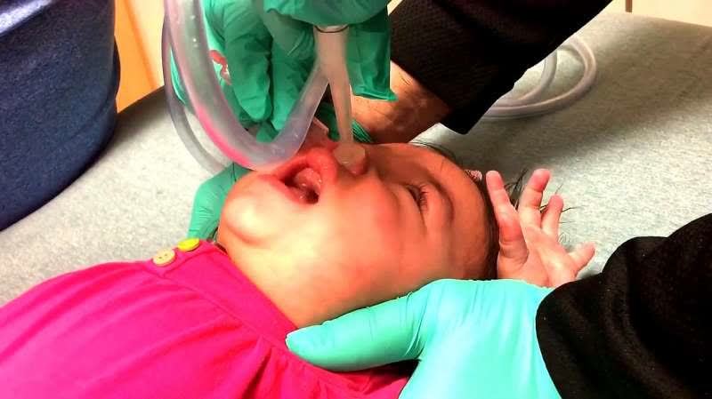 宝宝清理呼吸道垃圾,这样被抓着插管子,看着真让人难受