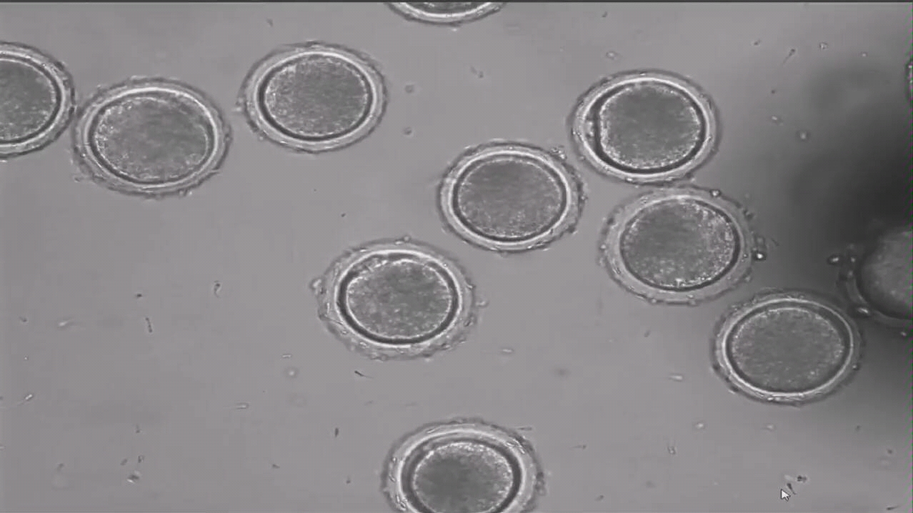 显微镜下的卵子