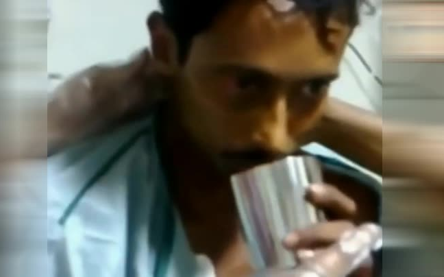 实拍狂犬病发作濒死宇宙大合集!恐水症太可怕了!(第一期)