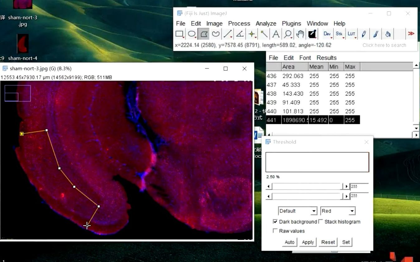 image j 脑片细胞计数