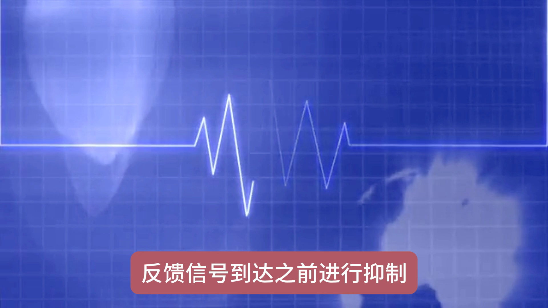 【专业音响科普】之6噪音反馈抑制器的选择要点!