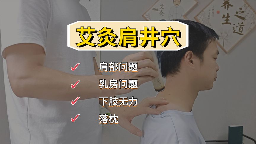 肩井穴艾灸实操:善调肩部问题、落枕、下肢无力,及女性乳房问题