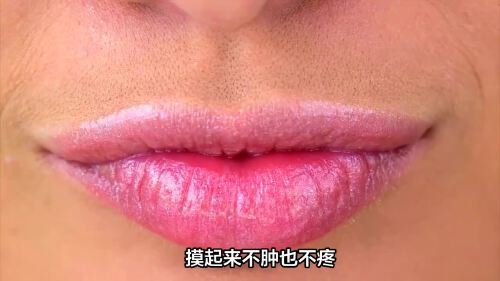 嘴唇发紫别大意!可能是心脏在求救,这2类原因要警惕