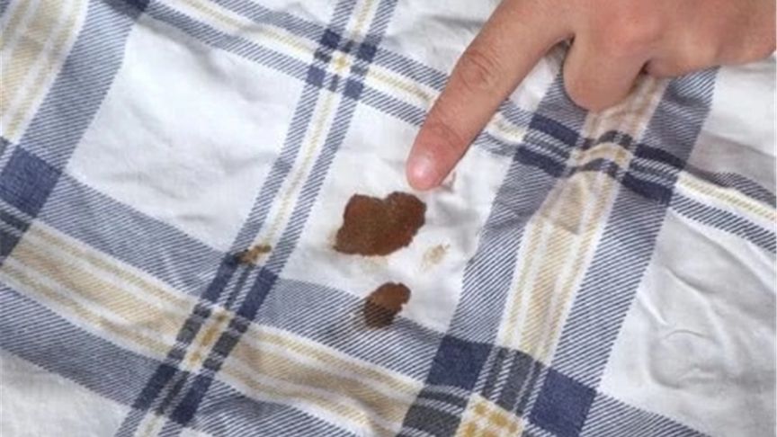 清洗床单血渍用热水还是冷水?教你一招,新老血渍都能轻松去除