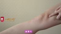 穴位艾灸——调理多囊卵巢综合征方法及注意事项