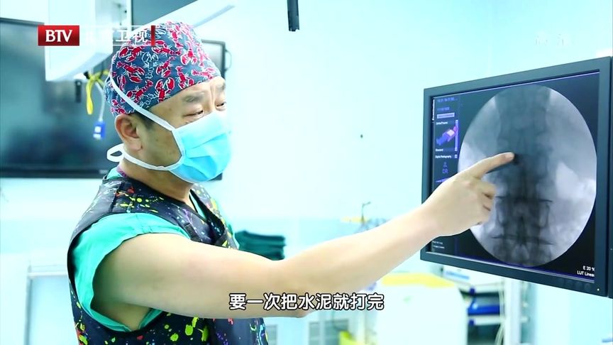 发生骨折后究竟是怎么治的?一起来看看新型微创的”椎体成形术“