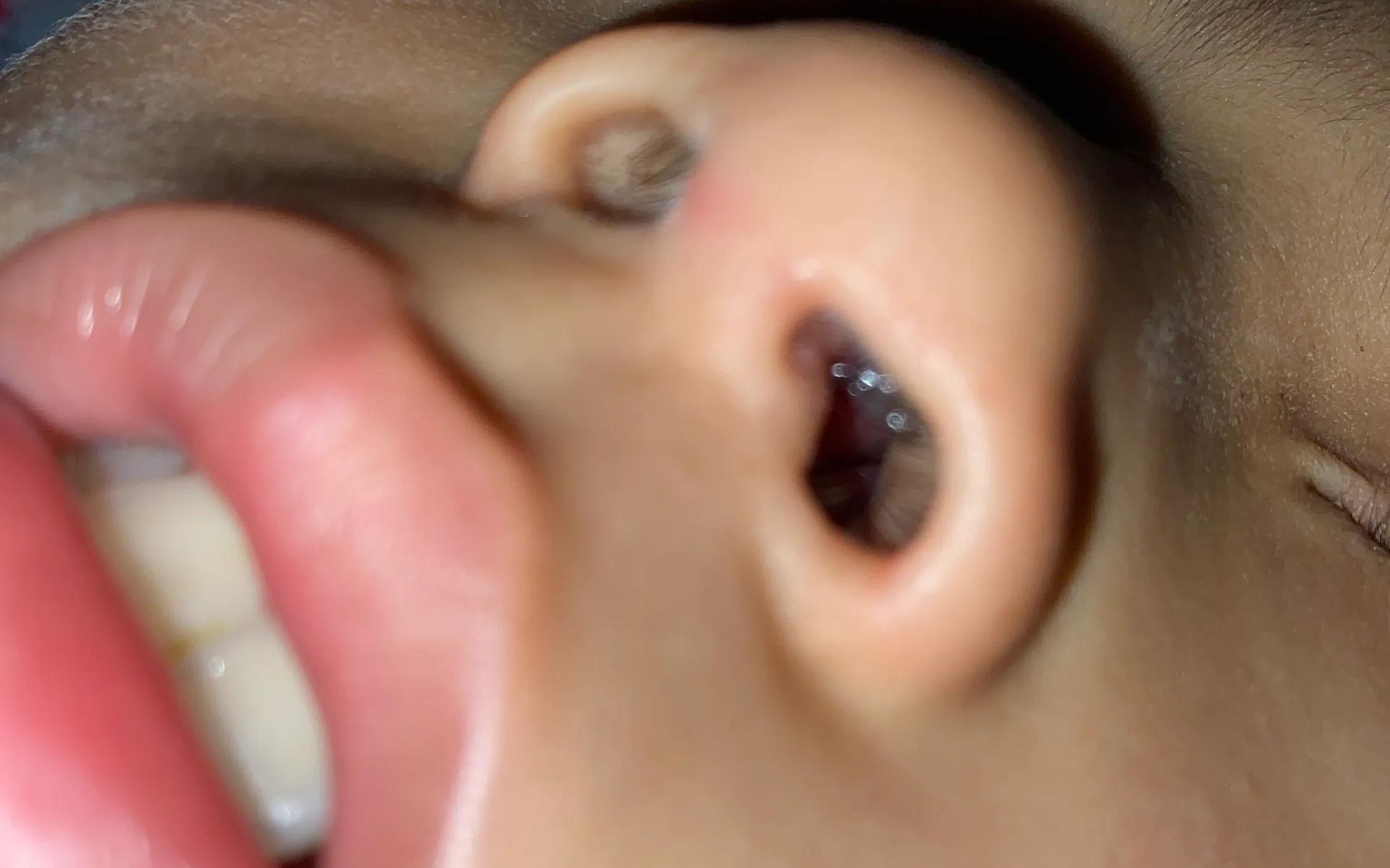 网上爆火的通气鼻贴真的好用吗?这款居然还能解决鼻炎!