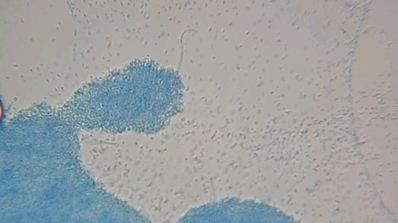 1000倍光学显微镜看细菌