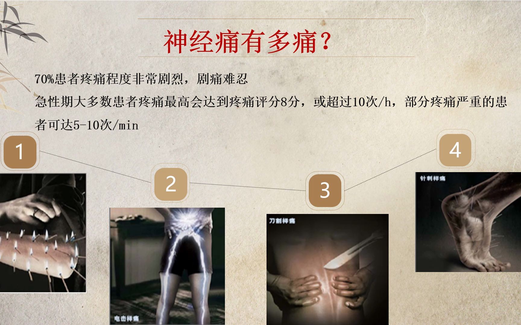 一例蛇串疮(带状疱疹)患者疼痛的个案护理PPT