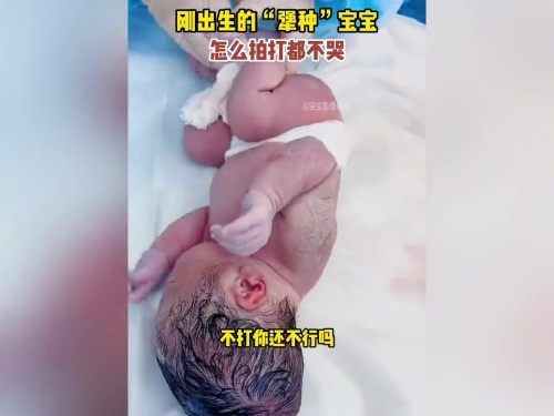 宝宝出生后,死活不哭!接下来的一幕让所有人目瞪口呆新生儿