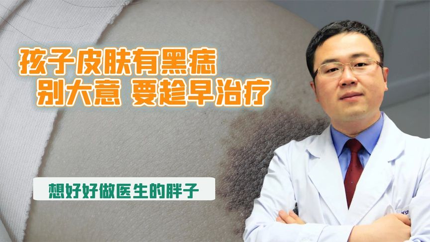 孩子身上有黑痣,别大意,及早咨询皮肤科医生,不要养虎为患!