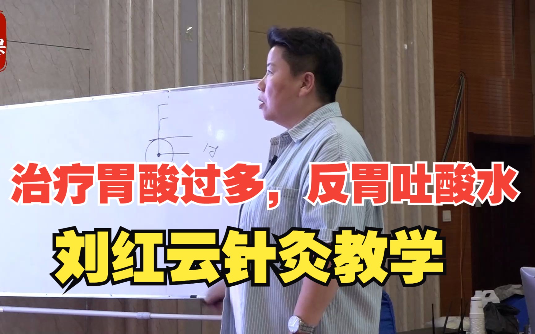 治疗胃酸过多,反胃吐酸水,刘红云针灸教学