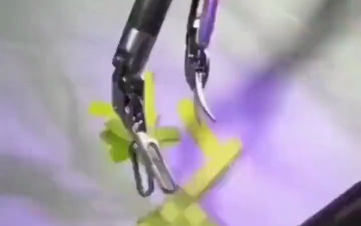 远程手术是偏远地区以后医疗的未来
